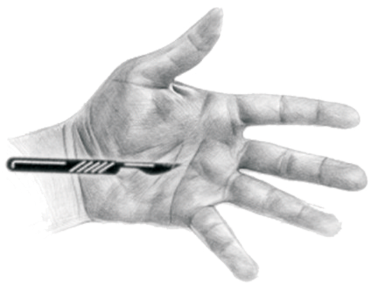 How to Reduce Swelling After Hand Injury? - Hand Surgery Surat